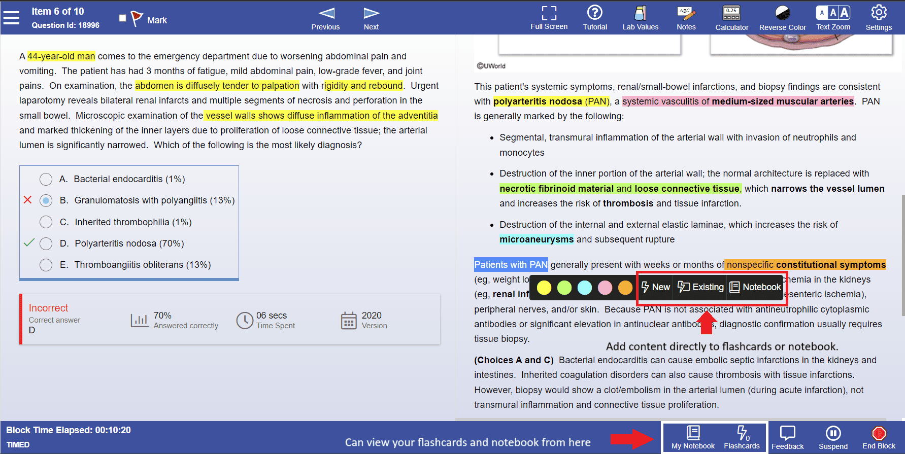 UWorld QBank for Step 1? 4 Criteria to Help You Decide